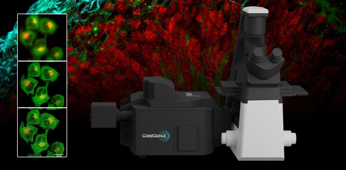 DeepSIM: super-resolution in a simple and budget-friendly way ...